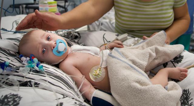 Chernobyl Birth Defects